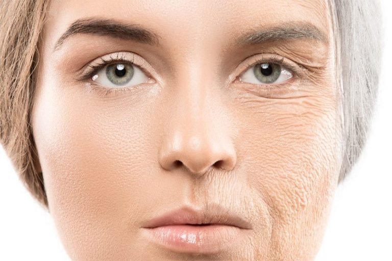 Você pode eliminar as rugas no rosto? - Clinica Florida Estética